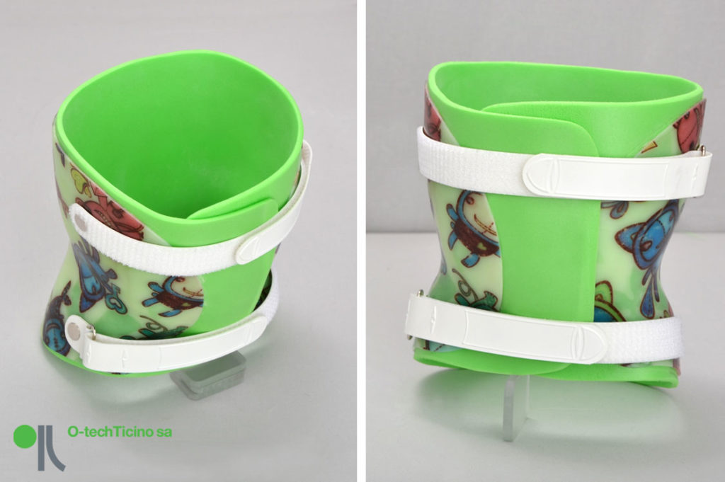 trunk / pelvis – Otech Ticino | Technical orthopedics laboratory