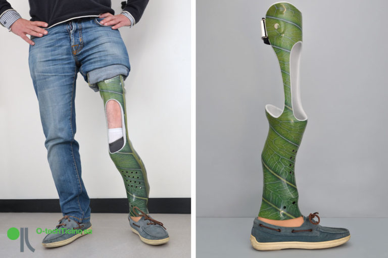 Orto-protesi – Otech Ticino | Laboratorio di ortopedia tecnica