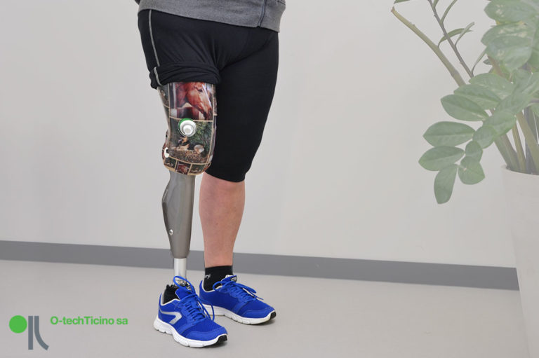 Protesi – Otech Ticino | Laboratorio di ortopedia tecnica