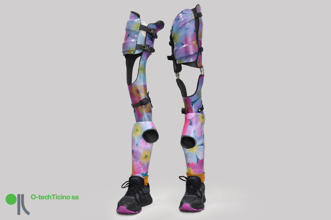 Ortho-prosthesis – Otech Ticino | Technical orthopedics laboratory